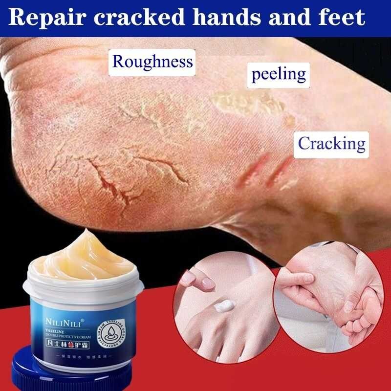 Whitening Niacinamide Crack Preventing Moisturizing And Anti Cracking ...