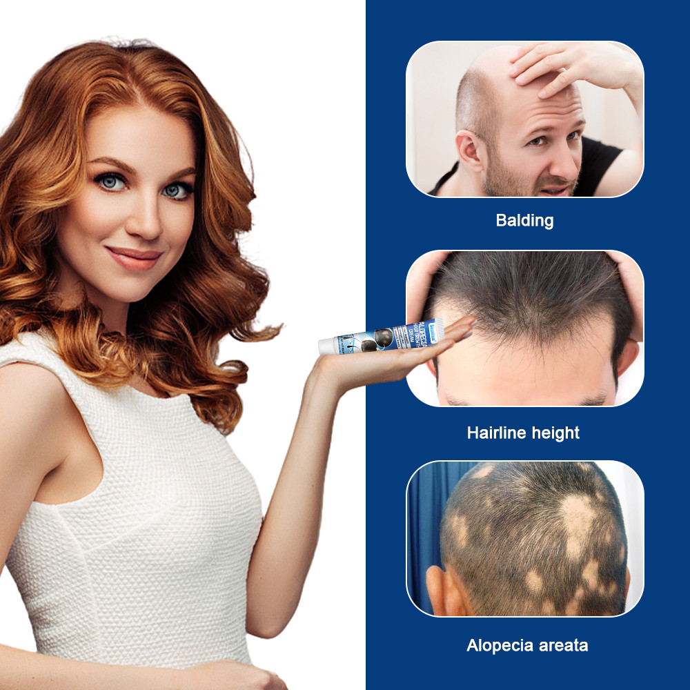1/5/10Pcs Sumifun Hair Growing Cream Alopecia Baldness Fast Regrowth ...