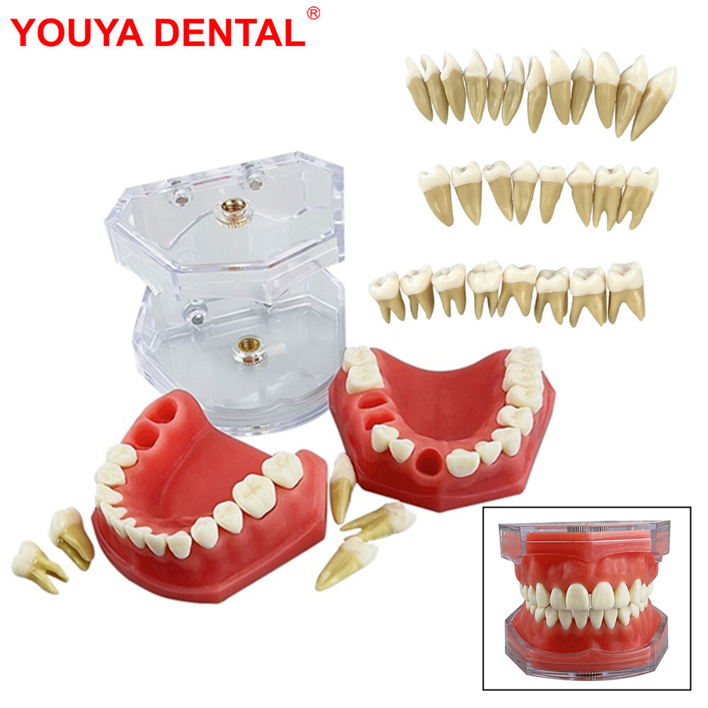 Typodont With Removable Teeth Soft Gum Tooth Extraction Pratice Model ...