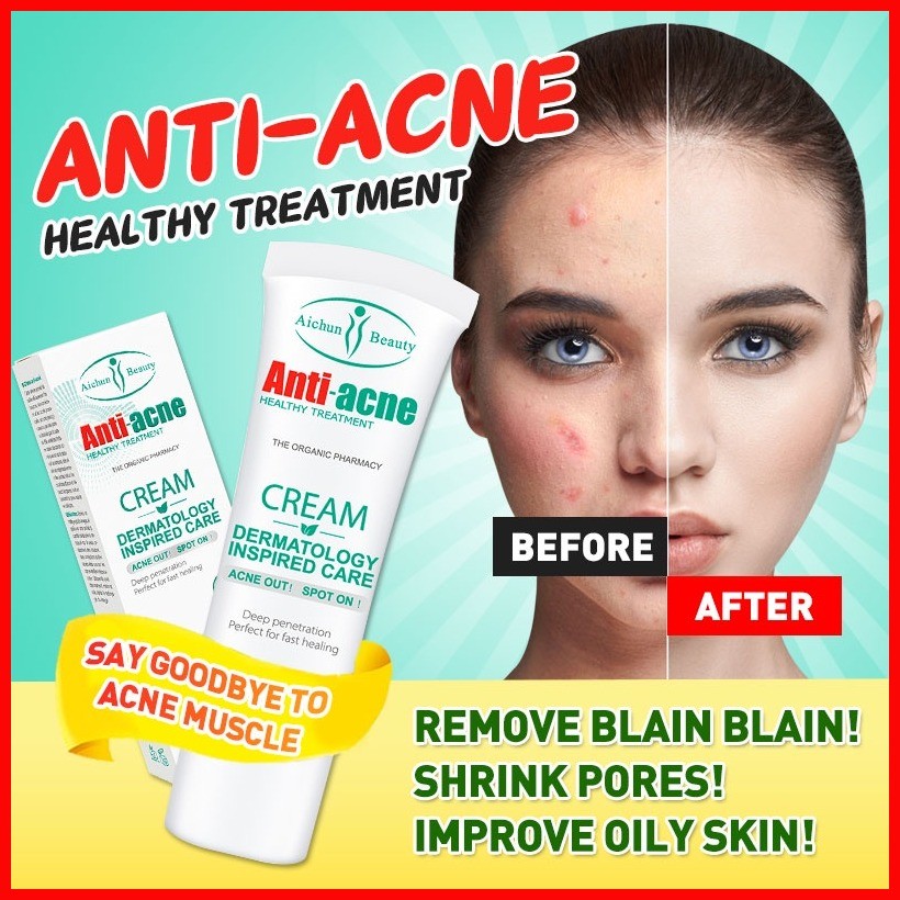 ♂ Acne remover Treatment Pimple Remover Marks keep face moisturized ...