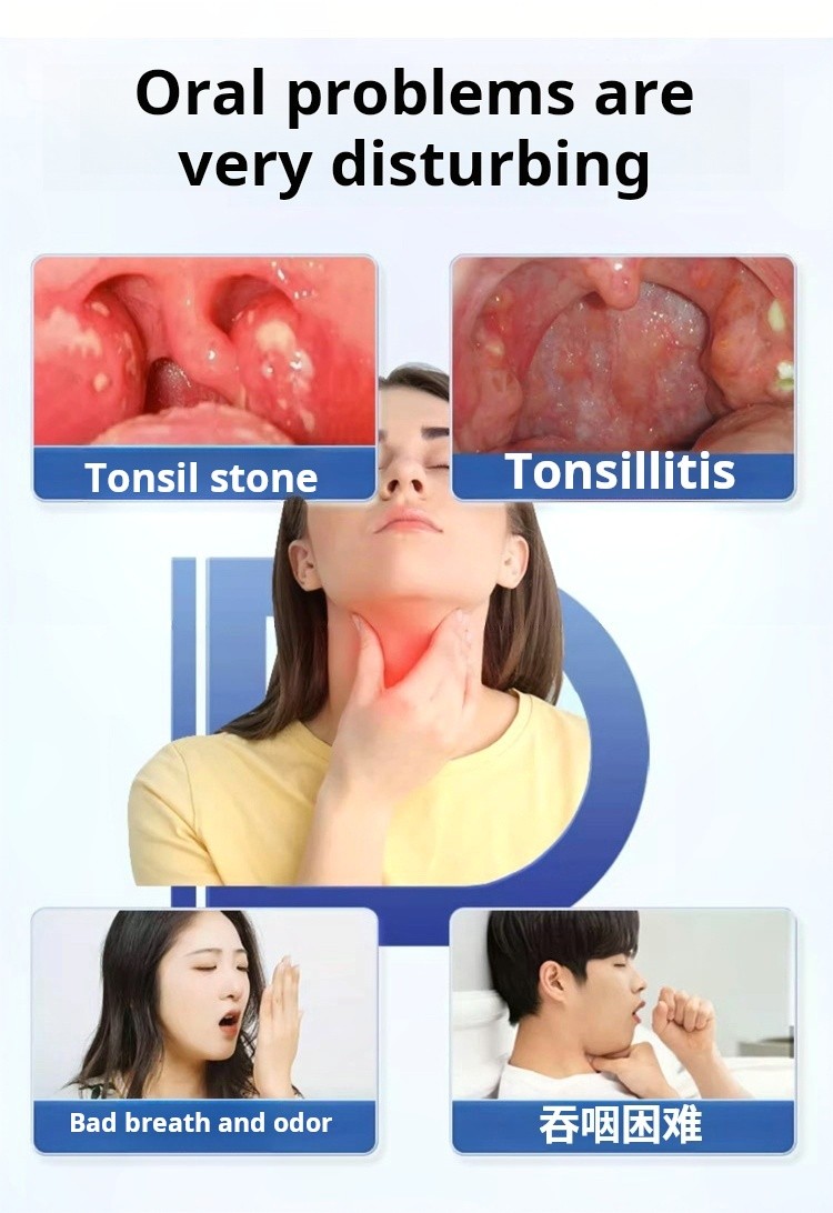 Oral Tonsil Clearing Mouthwash Spray Tools to Remove Bad Breath Stones ...
