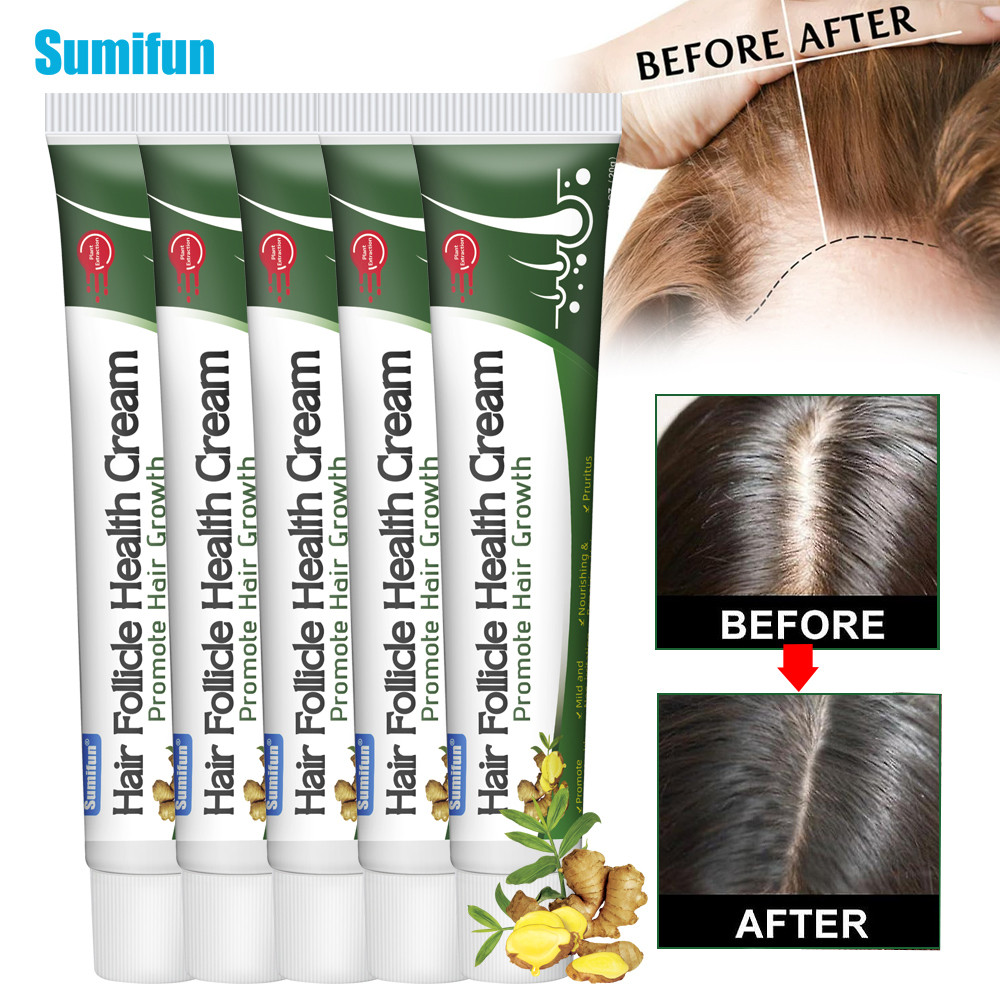 1/3/5/10Pcs Sumifun Follicle Cream Prevent Hair Loss Alopecia Baldness ...