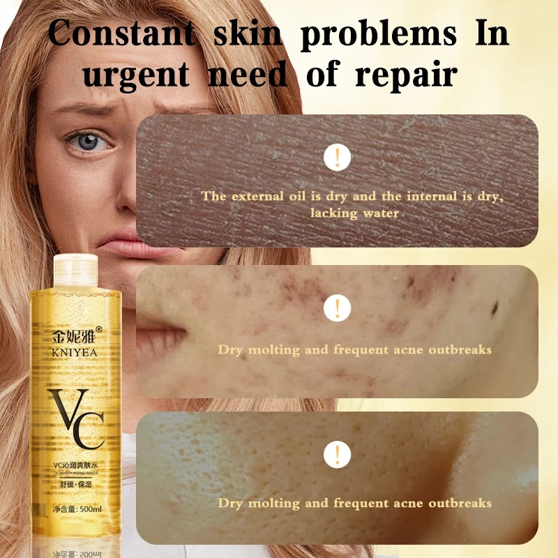 Vitamin C Toner Intensive Whitening Toner Essence Remove Melasma Acne Pimple Marks Skin Care ...