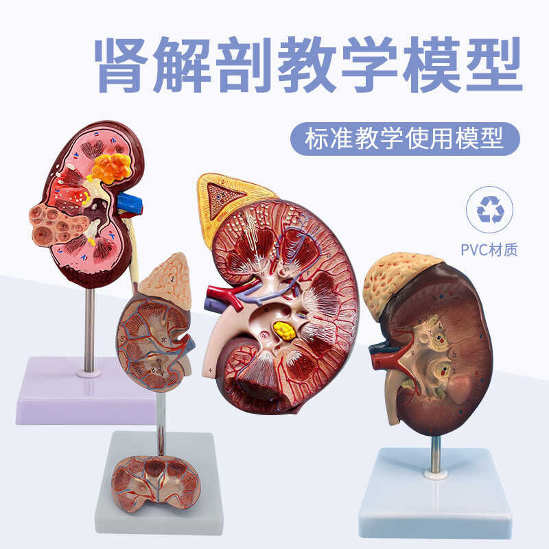 Human Kidney Model Kidney Anatomy with Adrenal Enlargement Model ...