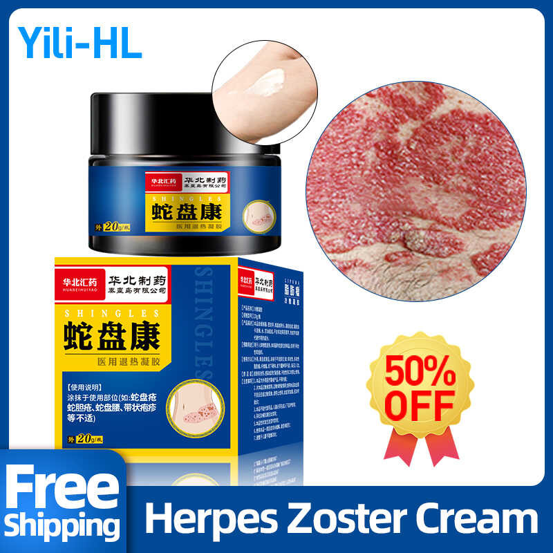 Zoster Treatment Cream Shingles Skin Remover Herpes Simplex Cure For ...