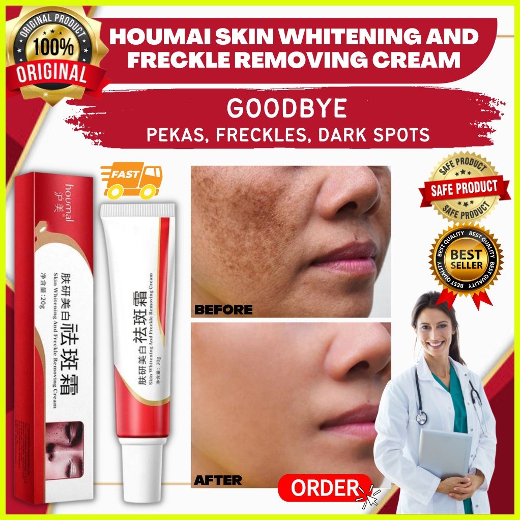 Original Pekas Remover - Whitening Freckle Cream, Effective Melasma ...