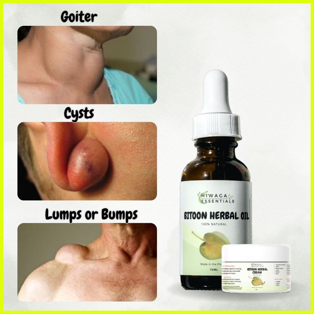 [Hiwaga] Pure Bitoon Herbal Oil with FREE Bitoon Herbal Cream 50g Gamot ...