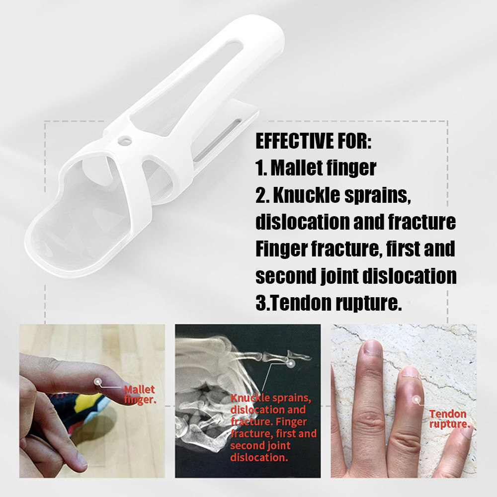 Finger Splints Mallet Brace Plastic Finger Support Finger Immobilizer ...