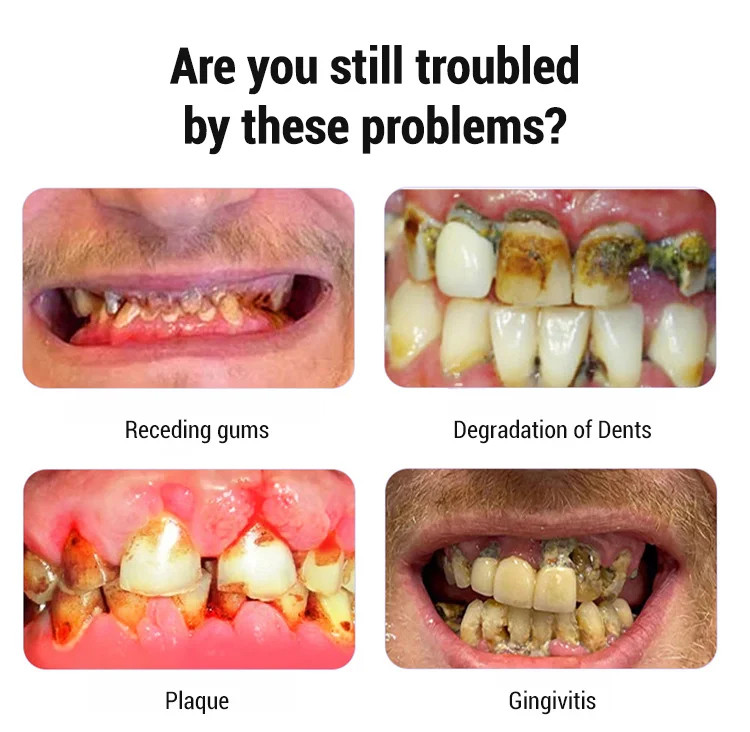 Sensitivity-Free/Natural Brightening】Gentle Teeth Stain Remover and ...