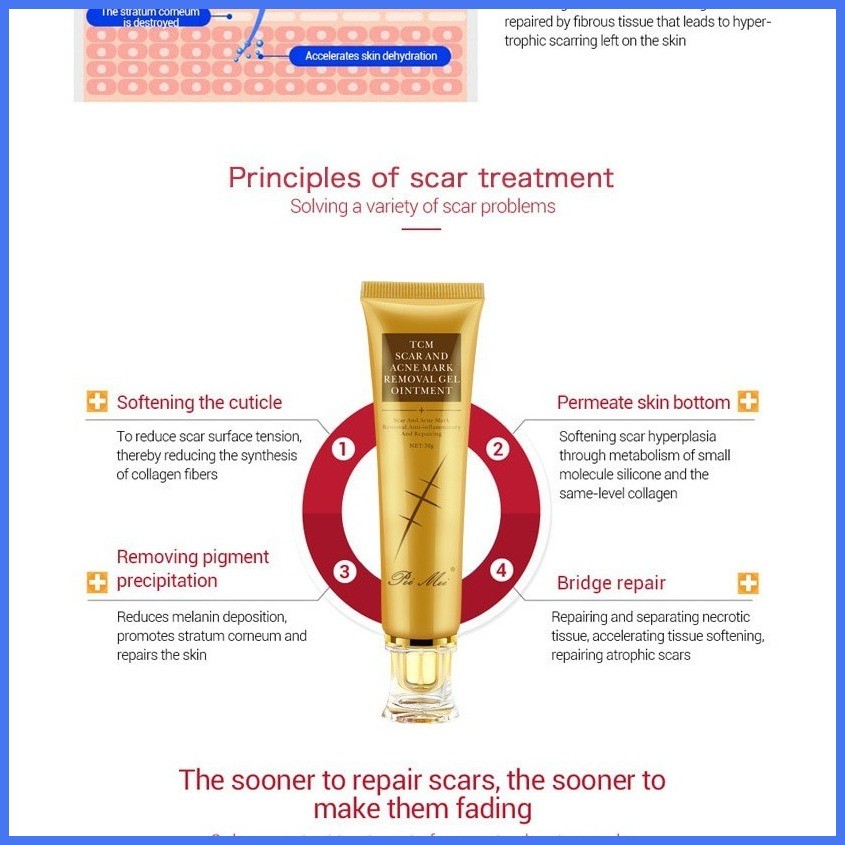 TCM Scar gel original Fixscar Acne scars removal for face Effective Stretch mark remover 30g ...