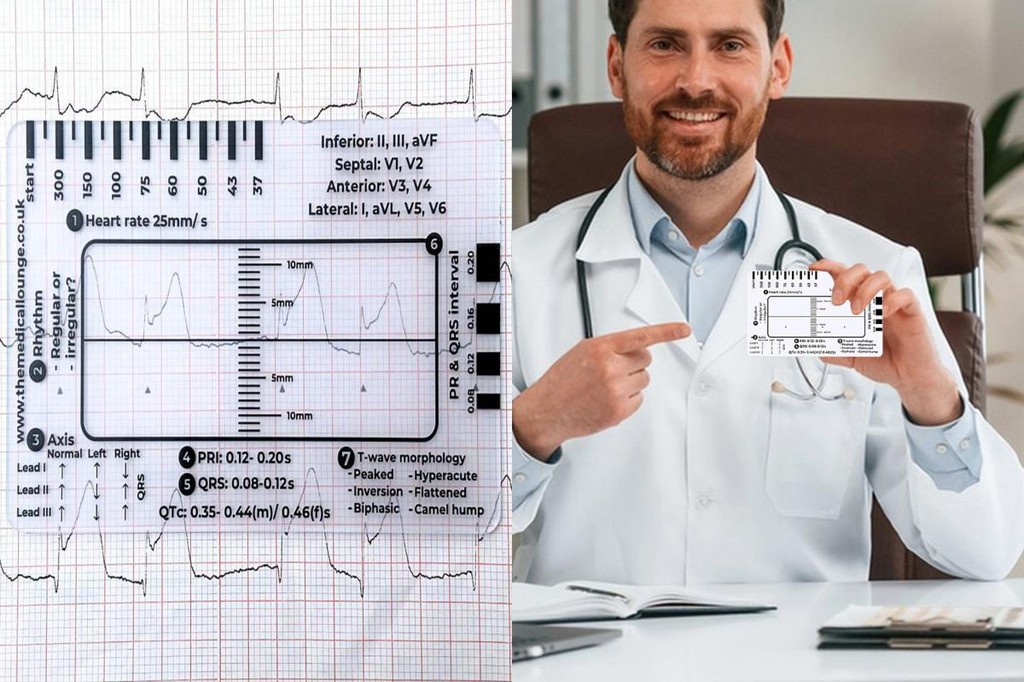 huangyan| Portable Ekg Guide Ekg Reference Card Transparent Ekg Caliper ...