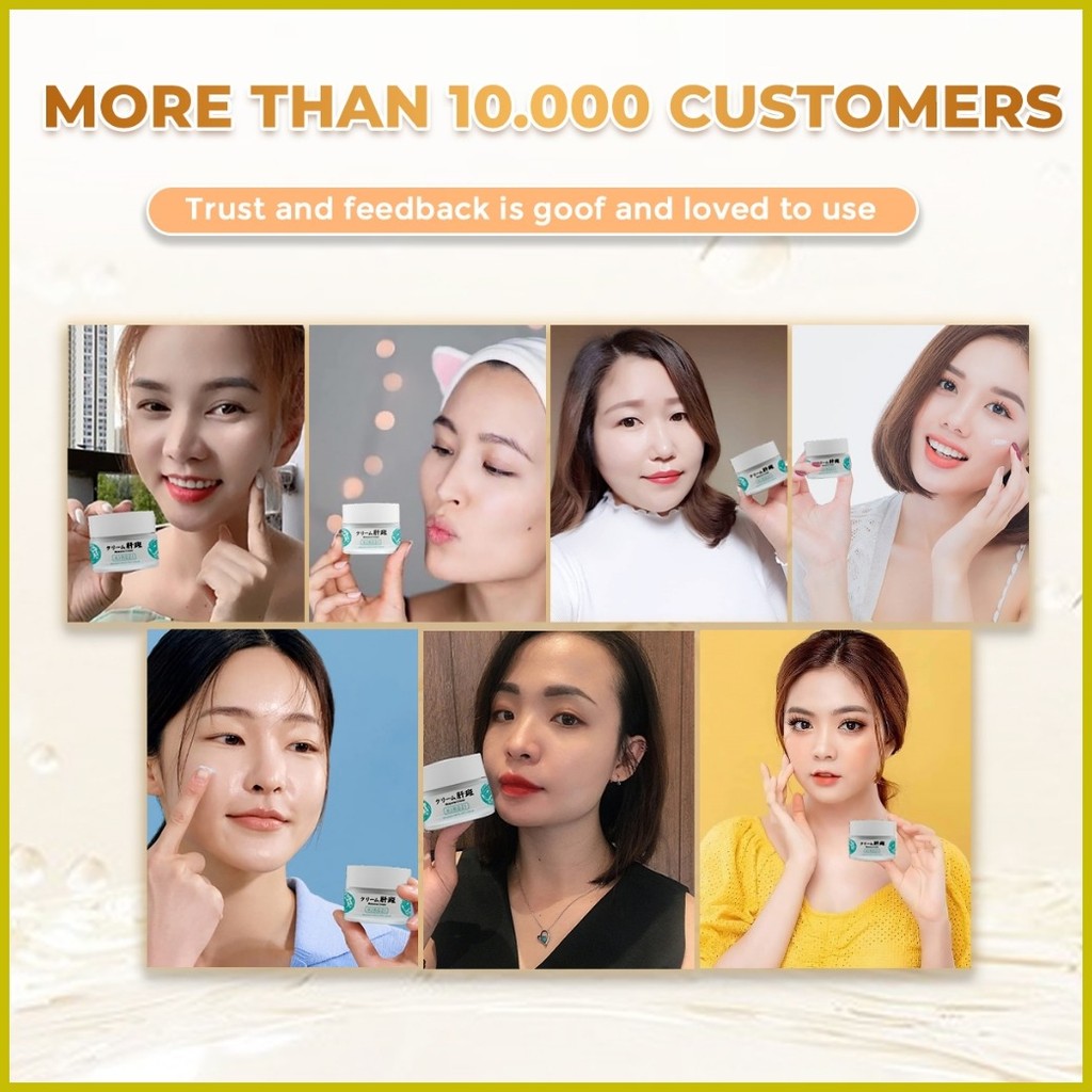 ♣ ⊙ Japanese Kirozi Melasma Cream - Pekas Remover Effective Anti ...