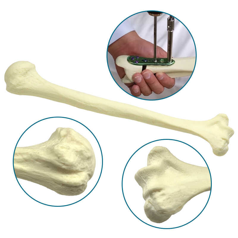 Cortical Shell Foam With Inner Cancellous Humerus Drilg Practice Human ...