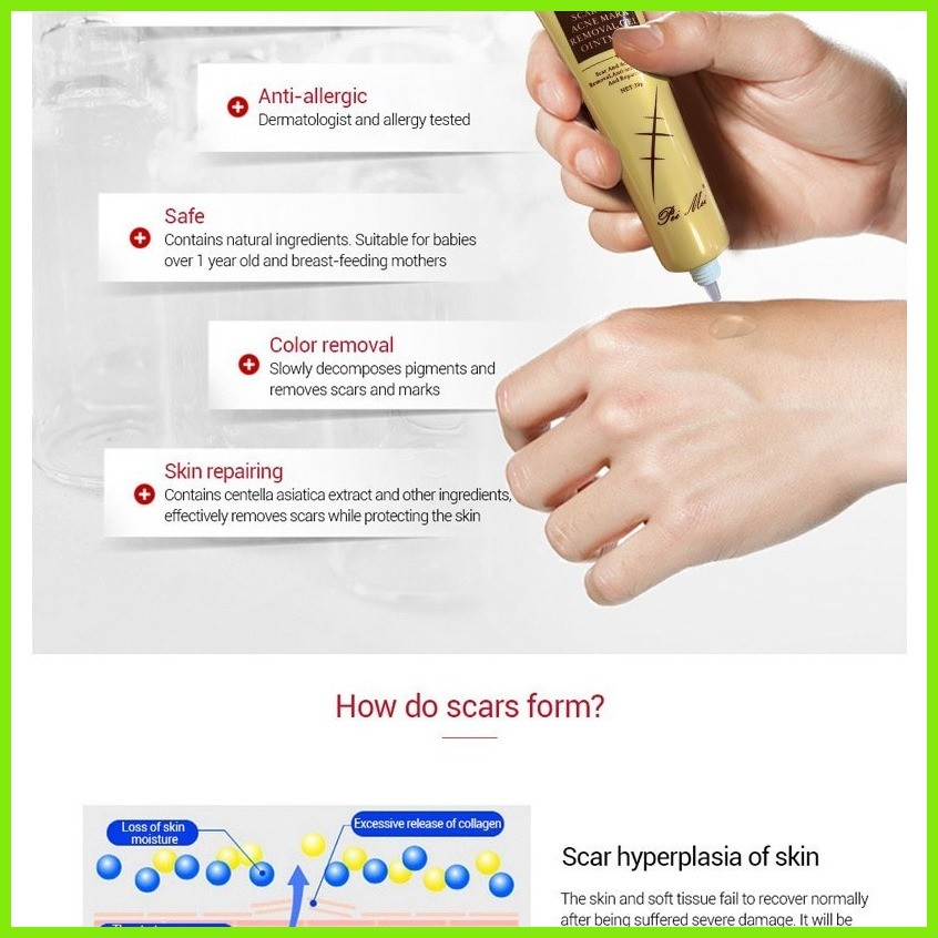 TCM Scar gel original Fixscar Acne scars removal for face Effective ...