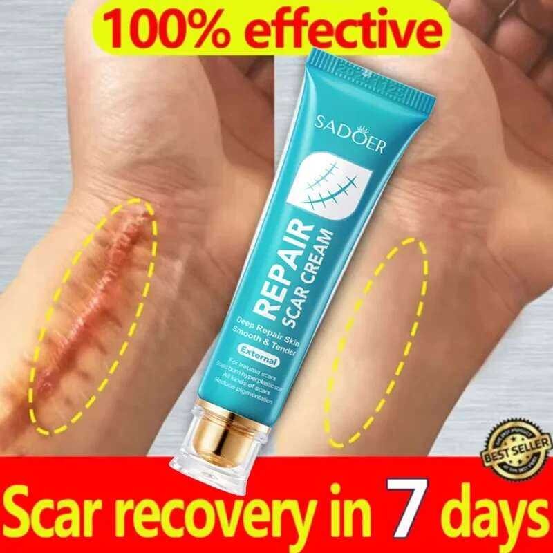Effective Scar Removal Cream Repair Stretch Marks Burn Acne Surgical Acne Scar Ointment Herbal ...