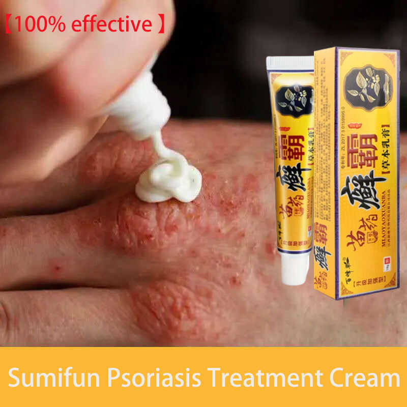 【Gamot Sa Kati Kati】Sumifun Eczema Treatment Cream Atoderma Original ...
