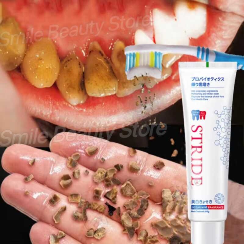 Dental Calculus Remover Teeth Whitening Toothpaste Tanggalin Ang Plaka ...