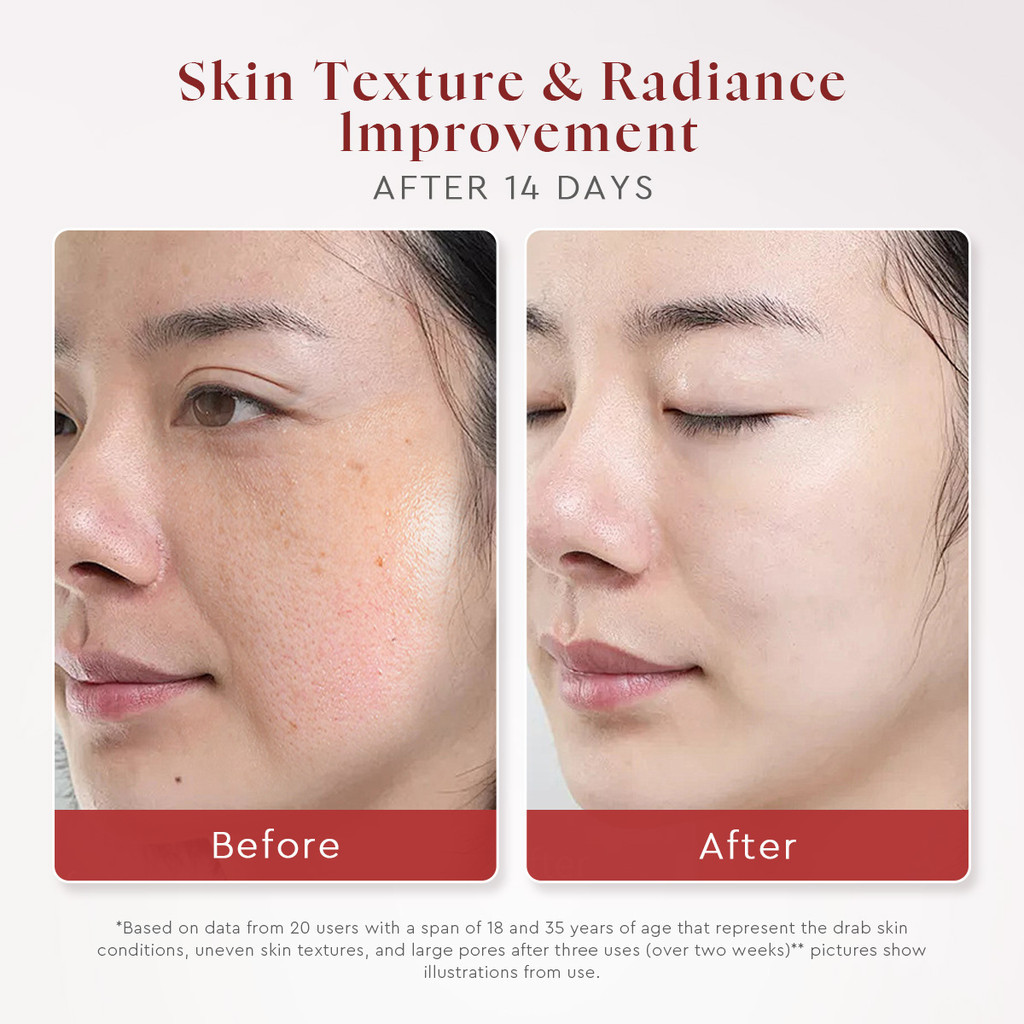 [TOP]Glad2Glow Aha Bha Pha Serum Intensive Peeling Solution Essence 60s ...