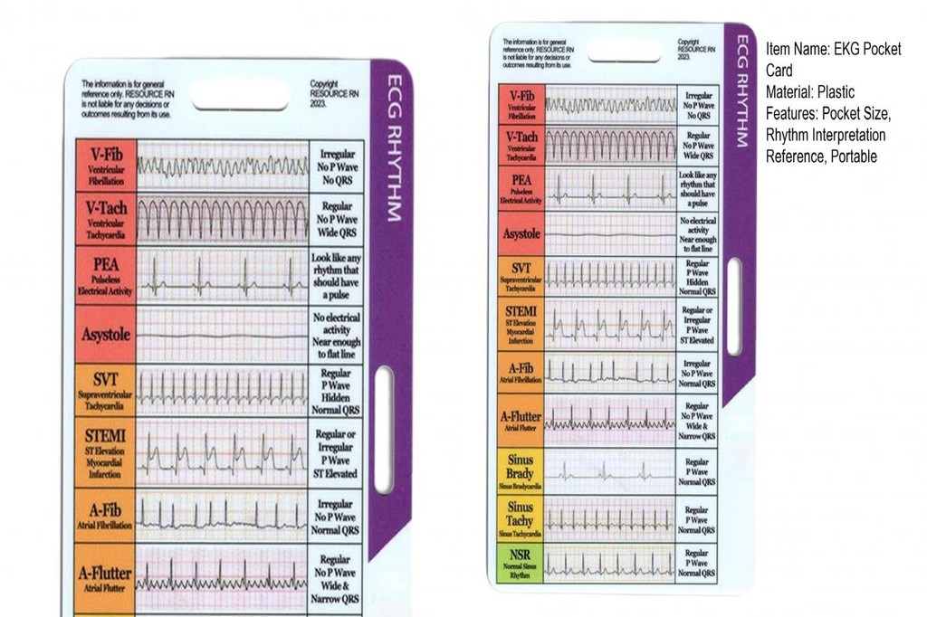 largesize| Ekg Rhythm Badge Card Quick Reference Ekg Guide Pocket Ekg Rhythm Interpretation Card ...