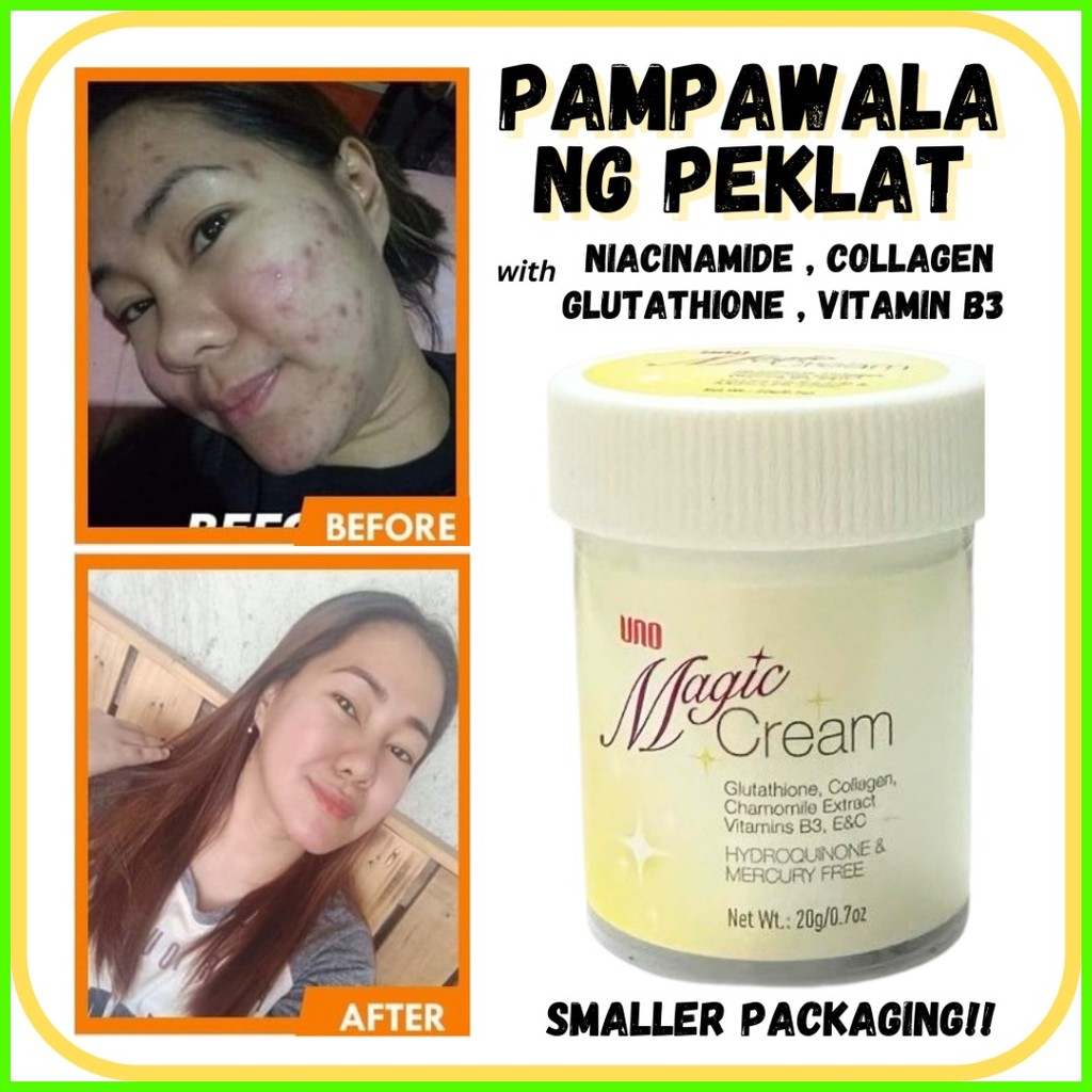 Niacinamide Scar / Stretch mark remover cream UNO Magic cream 100% ...