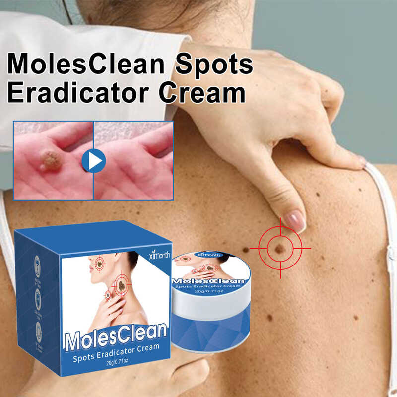 Scar Removal Ximonth Moles Clean Spots Eradicator Mole Cream Wart Skin ...