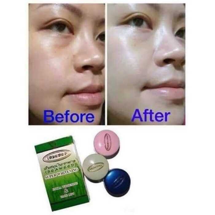 Face Extra Super Lifting Meyong Cream Set Made In Thailand | Shopee ...