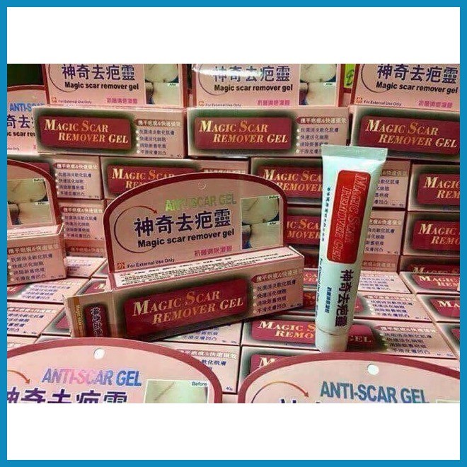 MAGIC Scar Remover Effective Magic Scar Mabisang pangtanggal PEKLAT ...