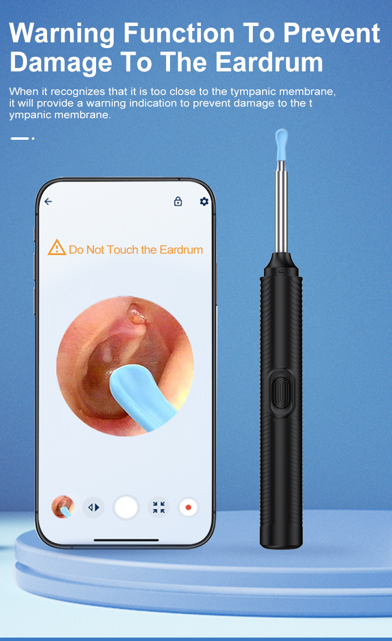SUNUO Smart Visual Ear Spoon With Camera HD Otoscope Endoscope Earwax ...