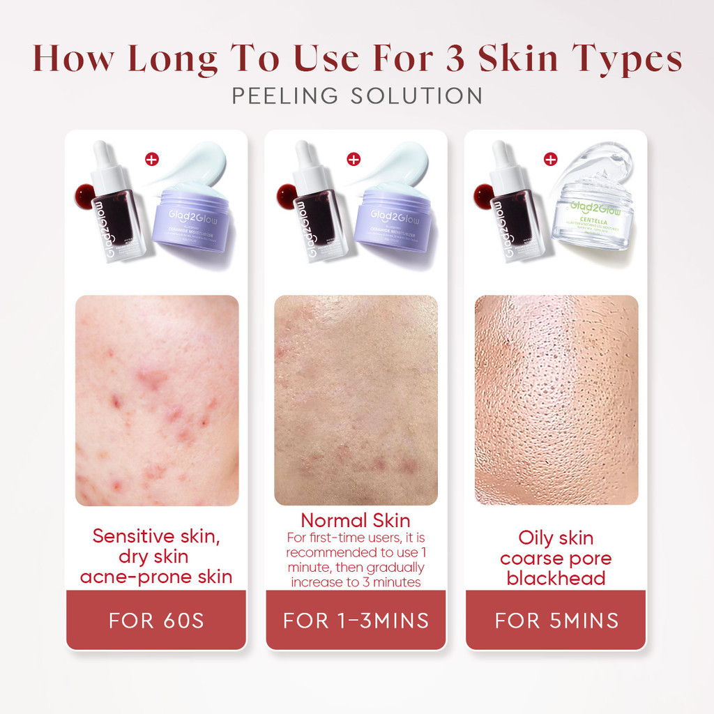 [TOP]Glad2Glow Aha Bha Pha Serum Intensive Peeling Solution Essence 60s ...
