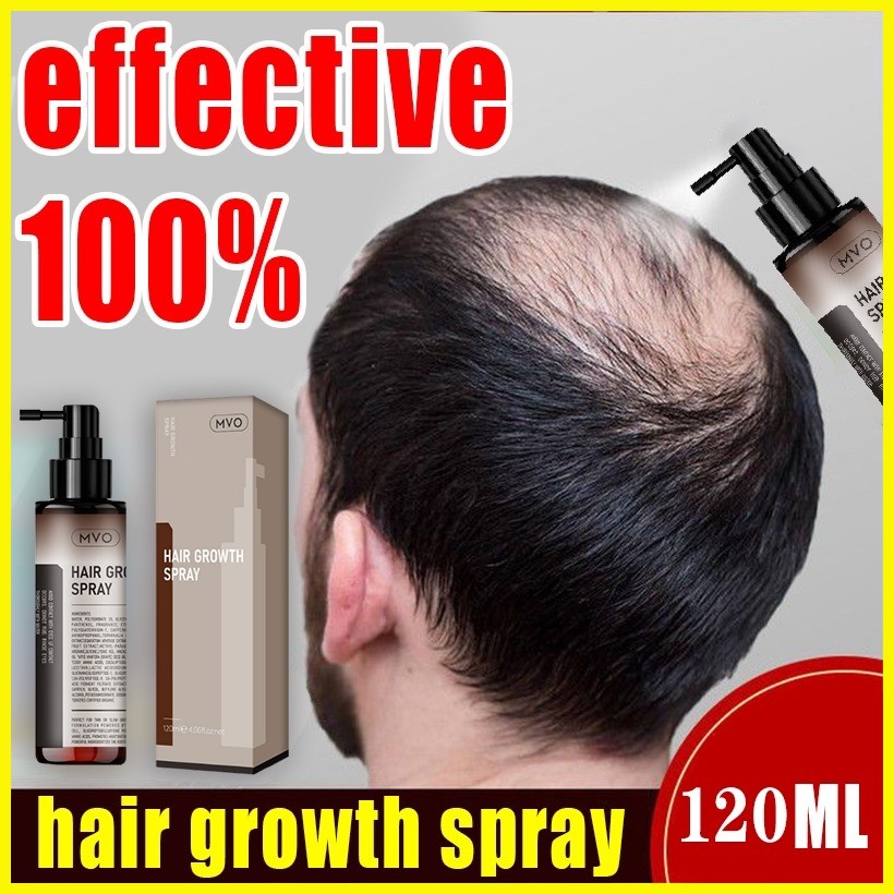 MVO Novu Hair Grower Pomade For Men Original/Hair Growth Serum Oil/Hair ...