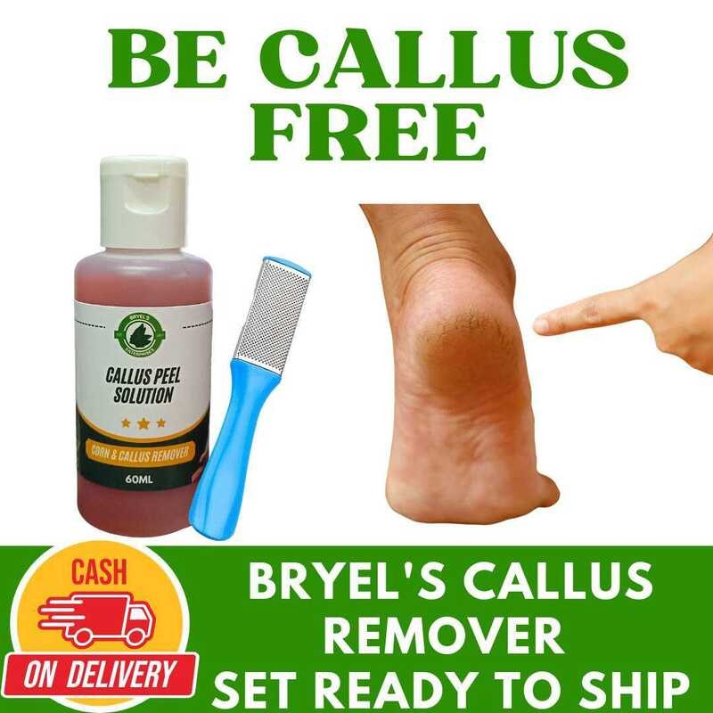 REMOVER ⚡⚡ 60 ML WITH FREE CALLUS PILE Pantanggal ng Kalyo sa Paa at ...
