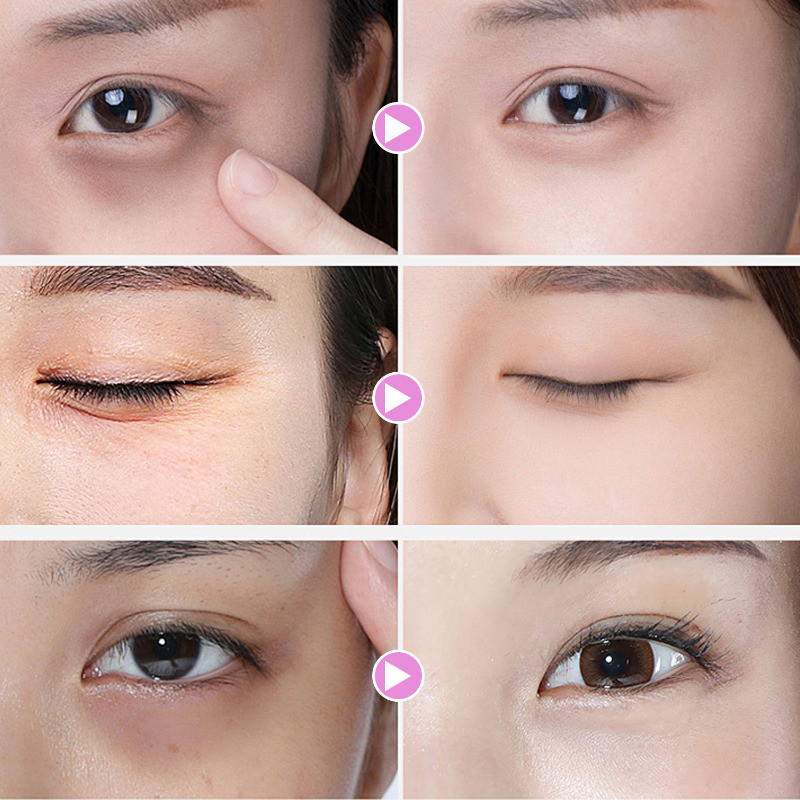 Purple Coconut Oil Eye Cream - Remove Dark Circles Serum Stick - Anti Wrinkle Fading Eye Lines ...