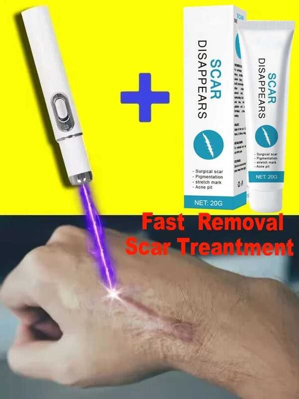 Recovery Scar Fast Remove Deep Skin Scar Acne Stretch Marks Burn Keloid ...