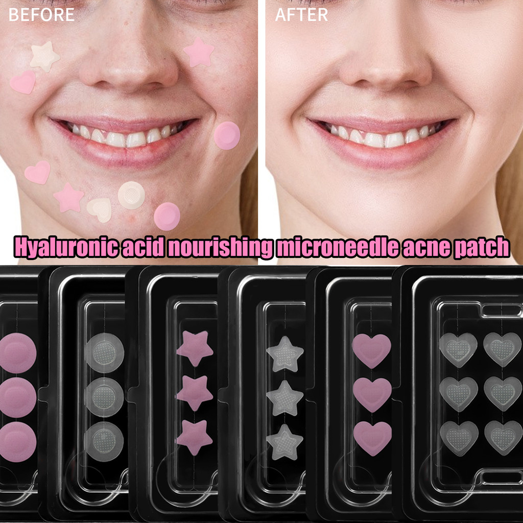 Soluble Painless Microneedle Acne Patch - Unique Heart-shaped Star ...