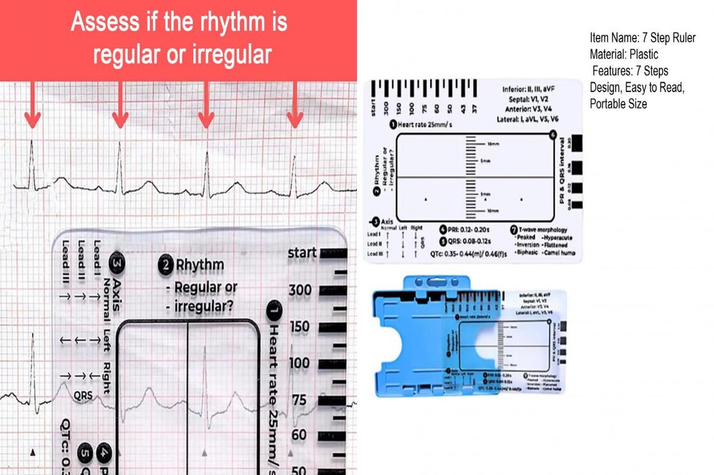 Ekg 7 Step Ruler Portable Ekg Guide Transparent Ekg Caliper Measuring ...