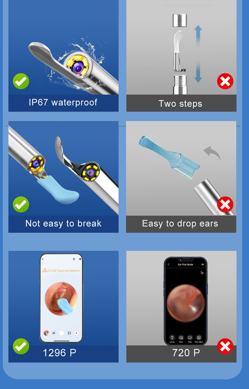 SUNUO Smart Visual Ear Spoon With Camera HD Otoscope Endoscope Earwax ...
