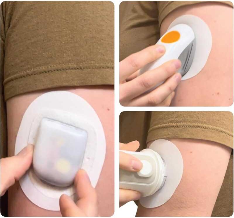 Glucomart Universal Underpatch G6 & Dexcom G7, Guardian, Libre Sensors ...