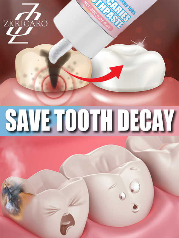 Anti-Cavity Toothpaste Tooth Remineralization Recovery Enamel Repair ...