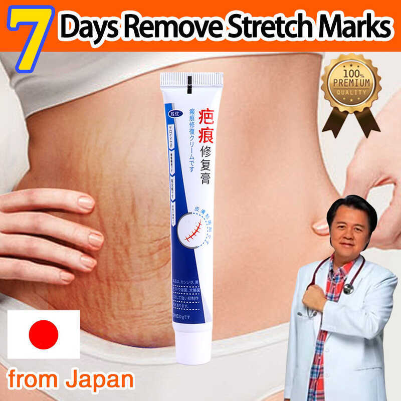 Stretch Mark Remover Cream Original Intensive Skin Treatment Anti ...