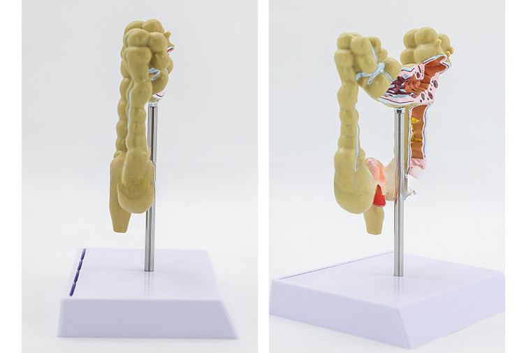 Large Intestine Pathology Model Small Large Intestine Model Large ...