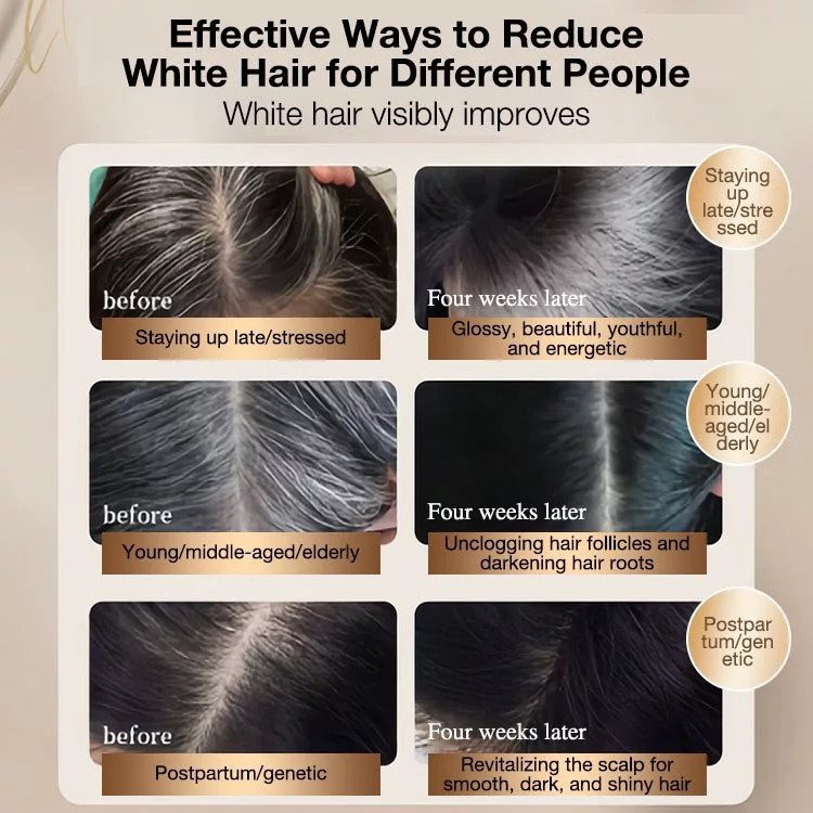 Saffron Hair Blackening Essence Spray 100ml Cover White Hair Herbal ...