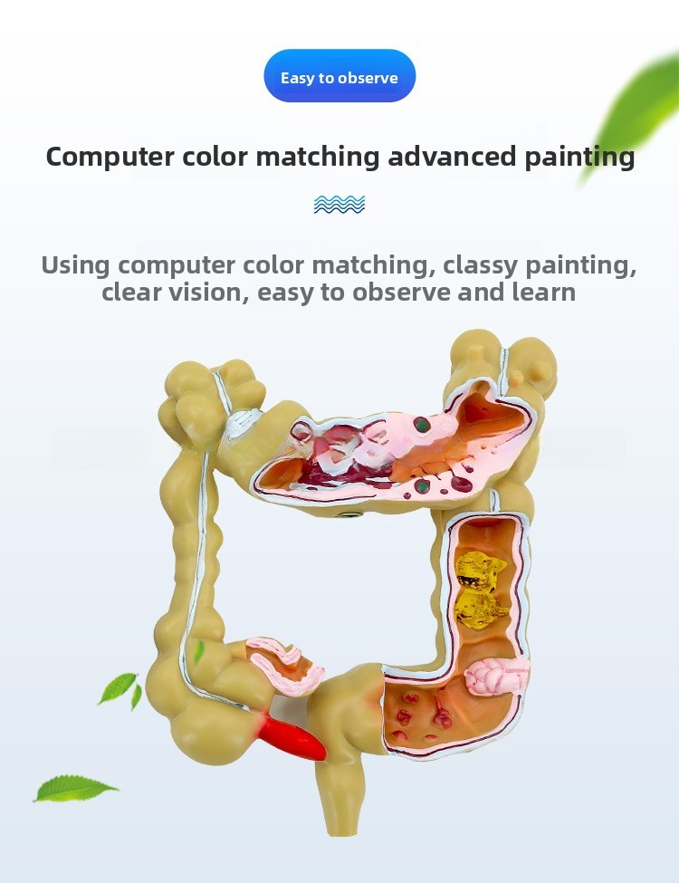 Large Intestine Pathology Model Small Large Intestine Model Large ...