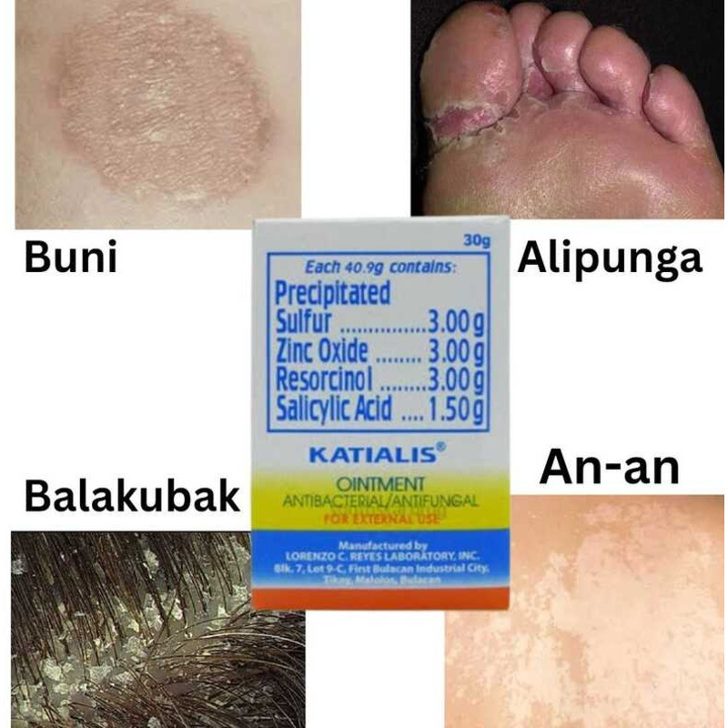 Anti-Fungal,/Anti-Bacterial Ointment: Gamot Sa An-An, Buni, Alipunga ...
