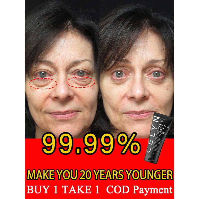 Bag Men Collagen Papa Peel Cream Wrinkles Eyebags Original Magic Balm ...