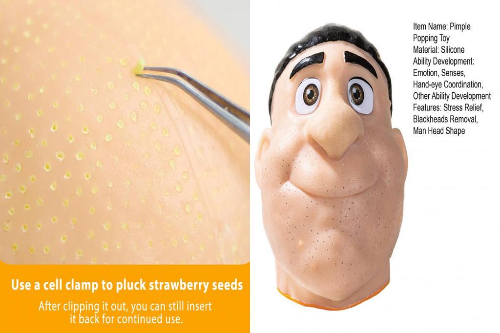 Wandereve| Blackhead Removal Toy Acne Decompression Toy Stress Relief ...