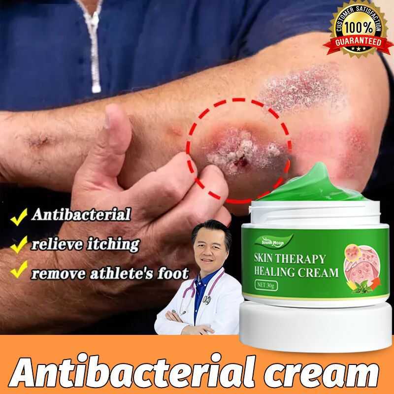 Gamot Sa Kati Balat Skin Fighter Atoderma Cream Original Ointments And ...