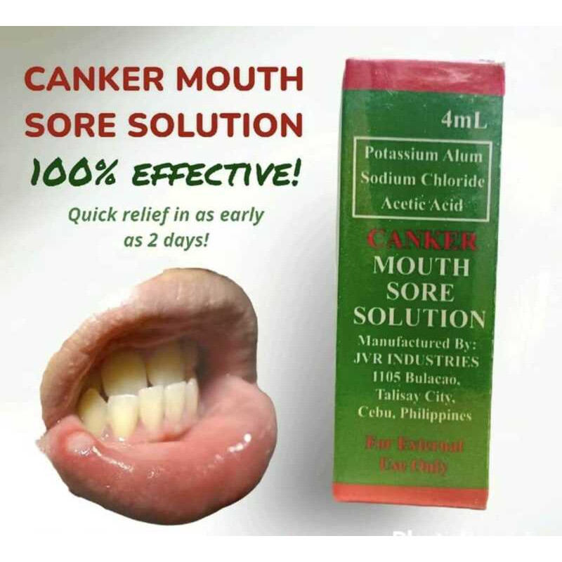 Canker Mouth Sore Solution Gamot Sa Singaw Be6 | Shopee Philippines