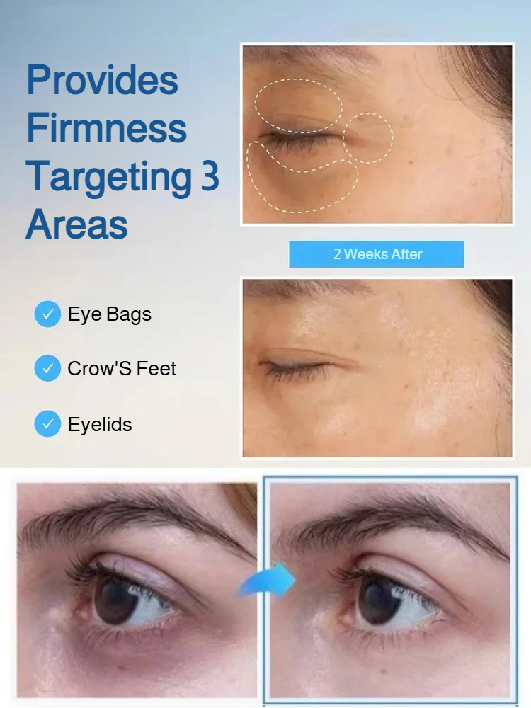 Protect your eye health Multi-purpose eye care gel / Treats blurred ...