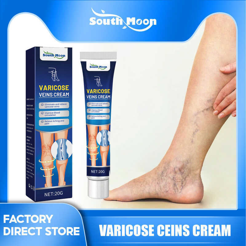 South Moon Veins Vasculitis Ointment Herb Plaster Beauty Varicose ...