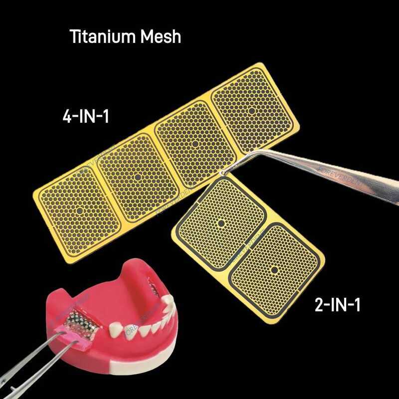 Dental Implant Titanium Mesh 2/ 4-In-1 Bone Regeneration Titanium Mesh ...